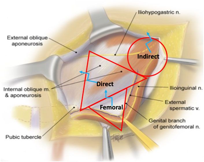 inguinal canal boundaries roof