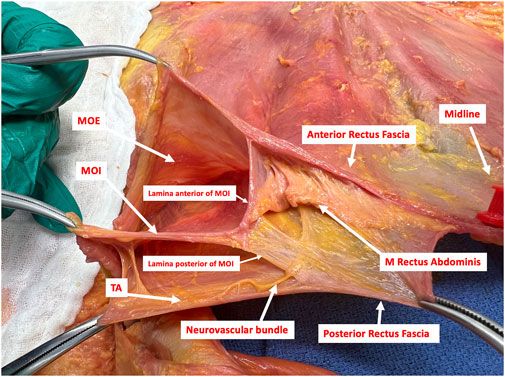 rectus sheath cadaver